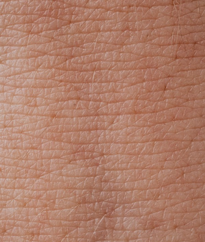 What is TEWL and how to prevent it | By Sarah Skincare